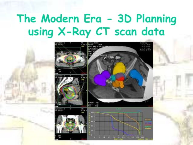 RT-GRID: Grid Computing for Radiotherapy | PPT