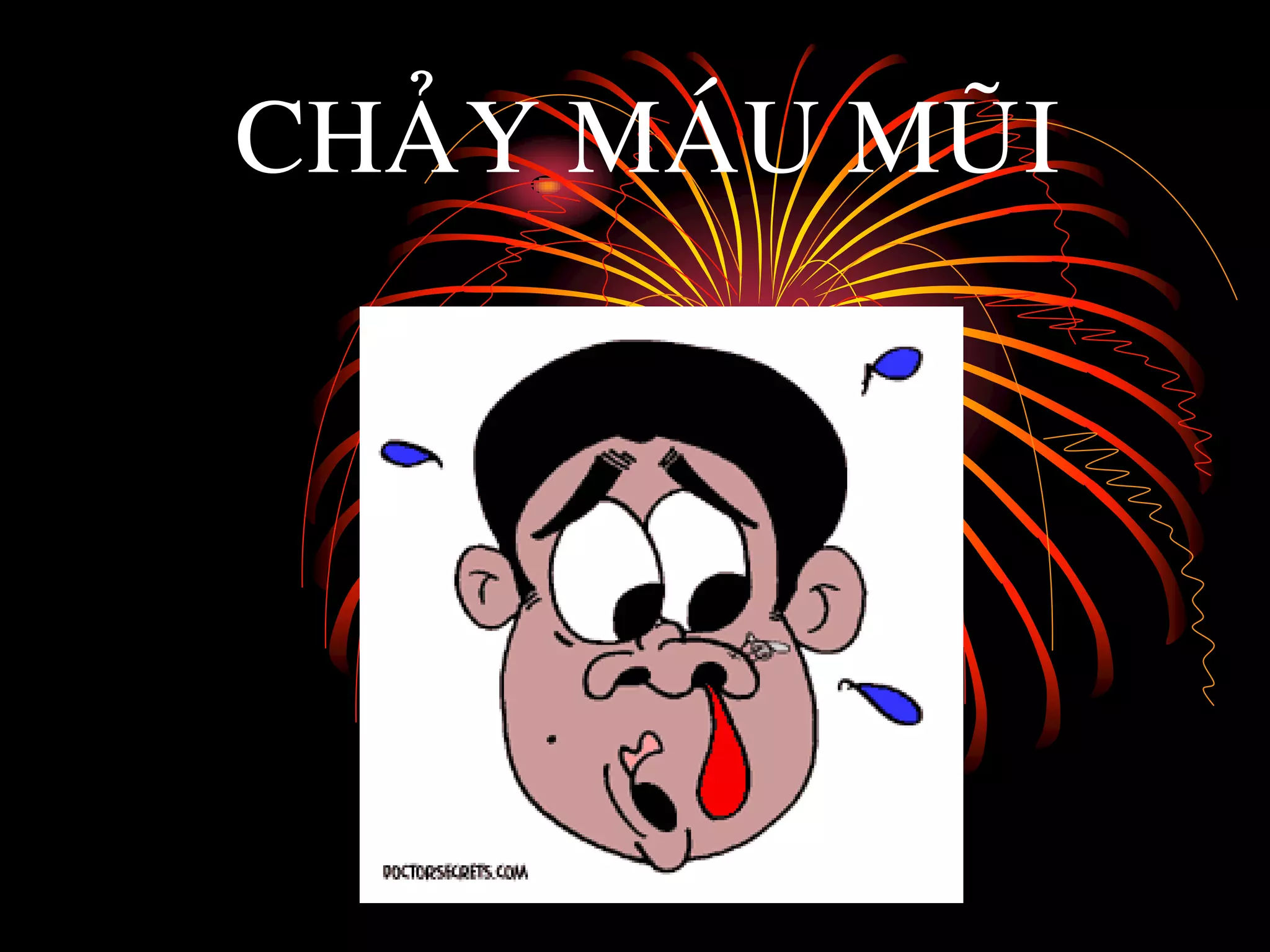 CHẢY MÁU MŨI | PDF