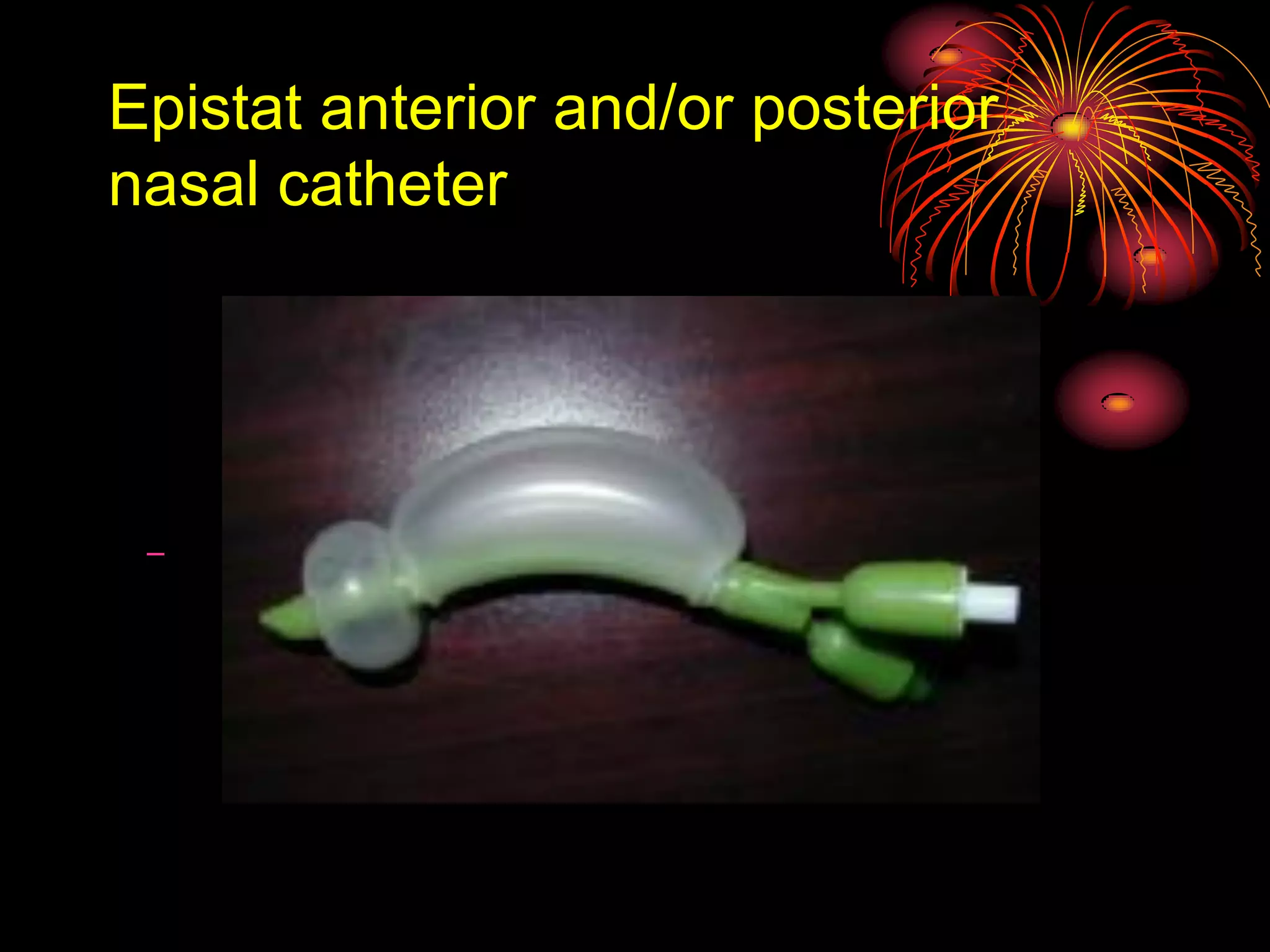 CHẢY MÁU MŨI | PDF