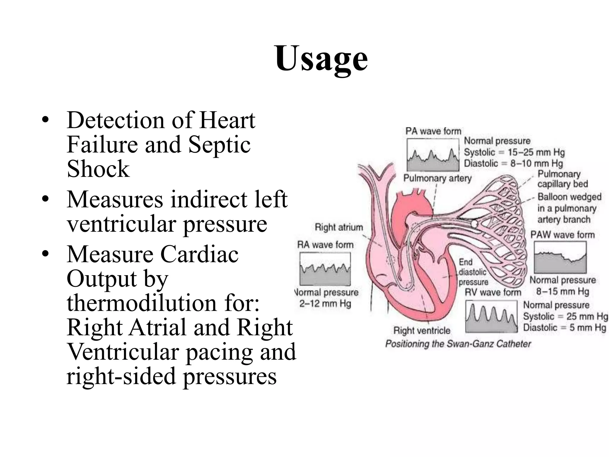 Right heart catheterization | PPSX