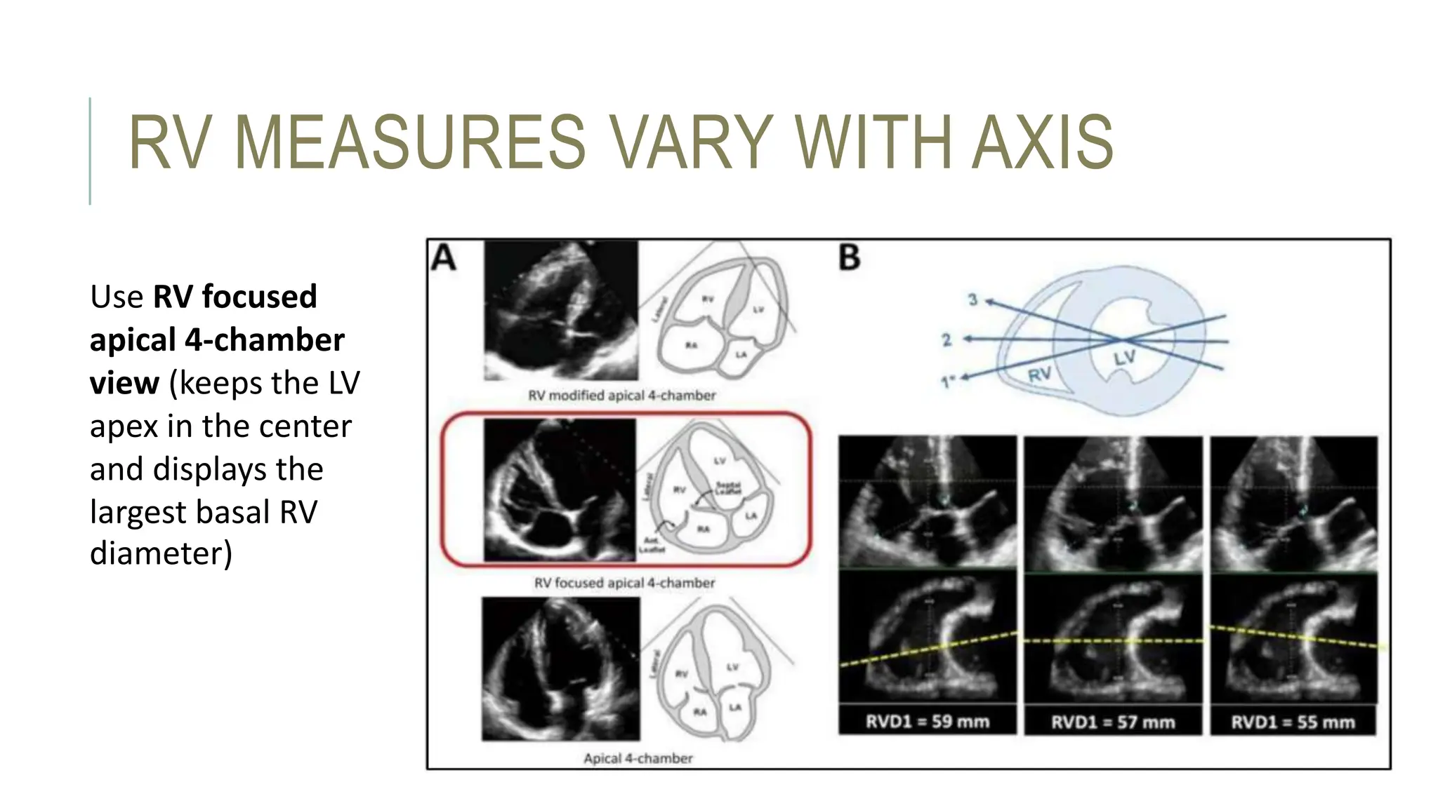 Right Heart, behind the Numbers .pptx