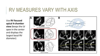 Right Heart, behind the Numbers .pptx