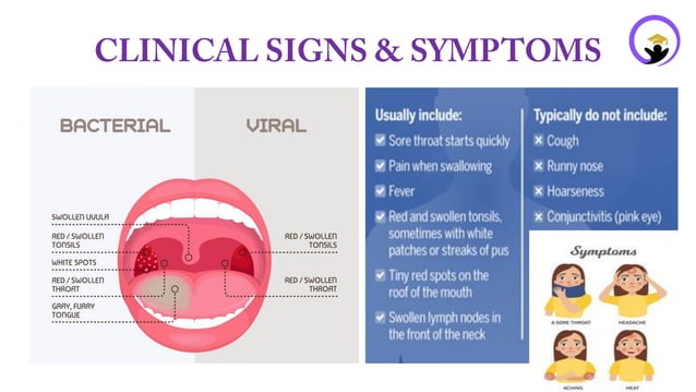 Acute Pharyngitis - Easy to learn and memorize drugs | PPT