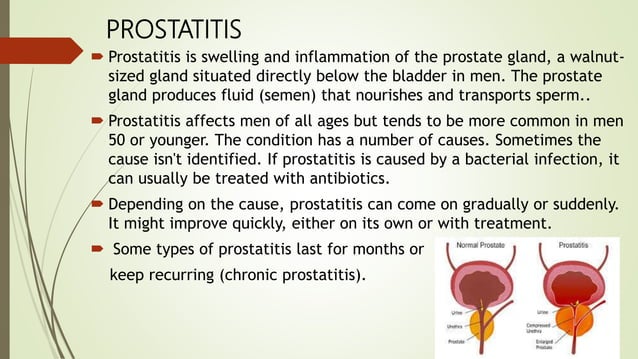 Reproductive tract infection | PPT