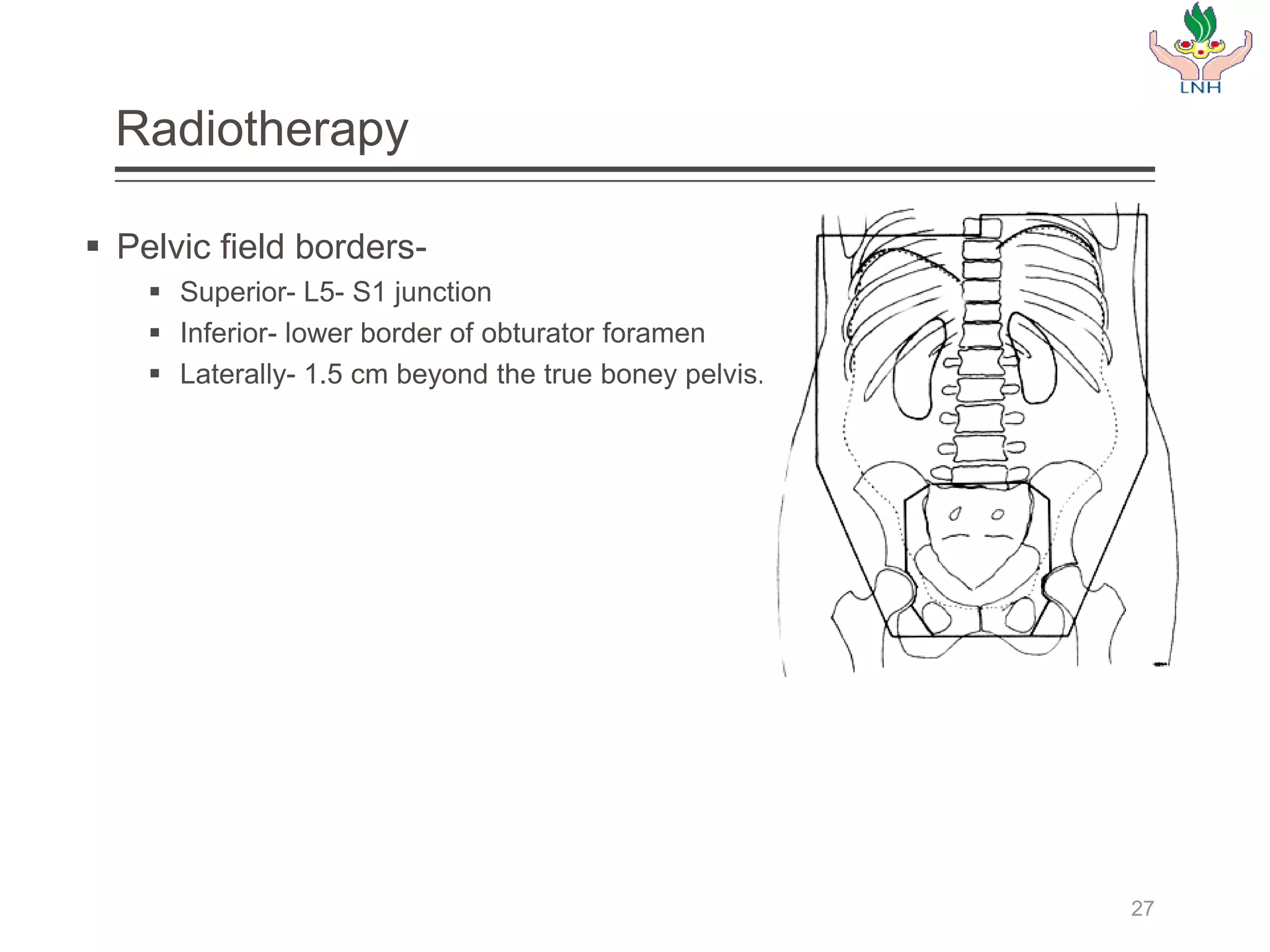 RADIOTHERAPY IN CARCINOMA OVARY | PDF