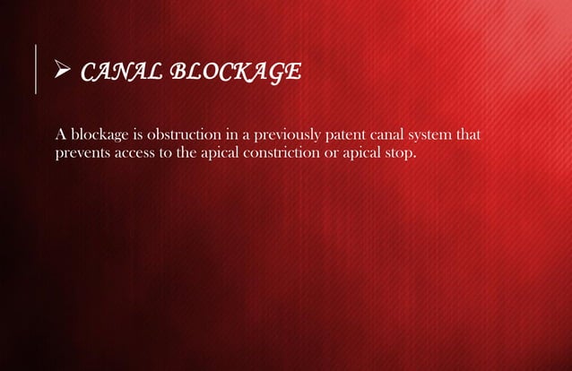 Endodontic mishaps during RCT | PDF | Dental Health | Diseases and ...