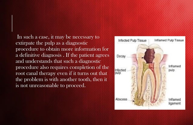 Endodontic mishaps during RCT | PDF | Dental Health | Diseases and ...