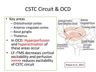 rTMS in OCD | PPTX