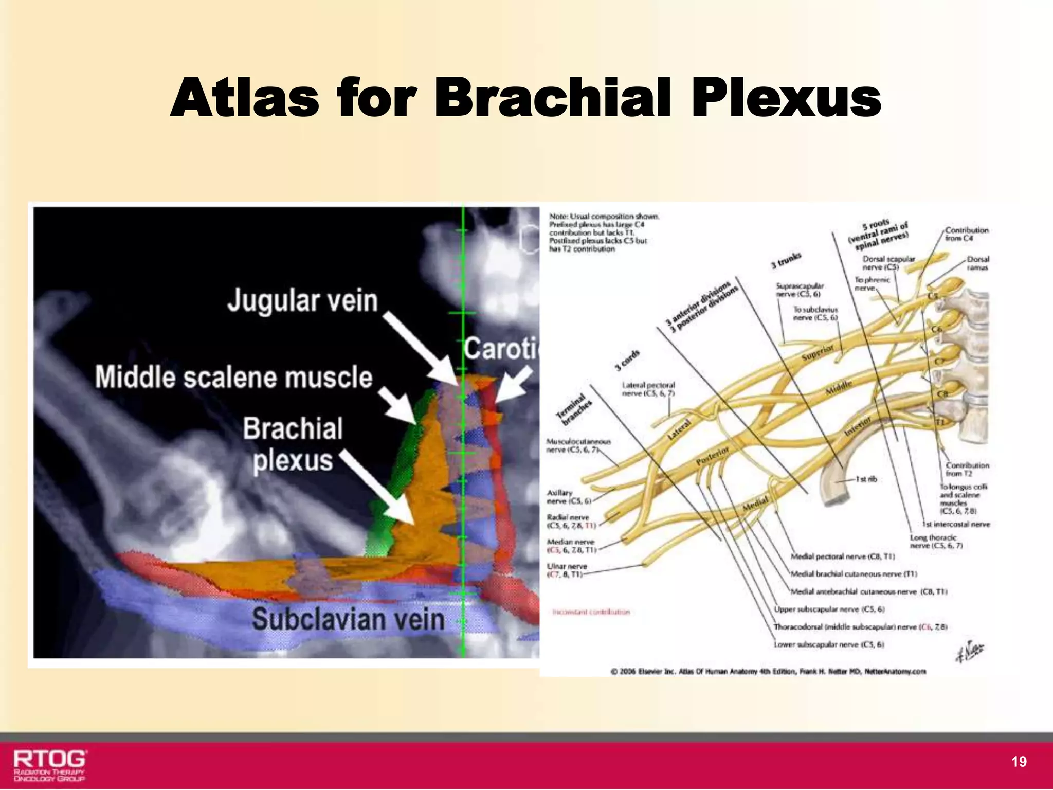 RTOG 1106 OAR Atlas Thoracic Radiation Therapy.ppt