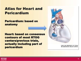 RTOG 1106 OAR Atlas Thoracic Radiation Therapy.ppt