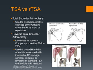 Reverse Total Shoulder Replacement: Anatomy, Rehabilitation, and ...