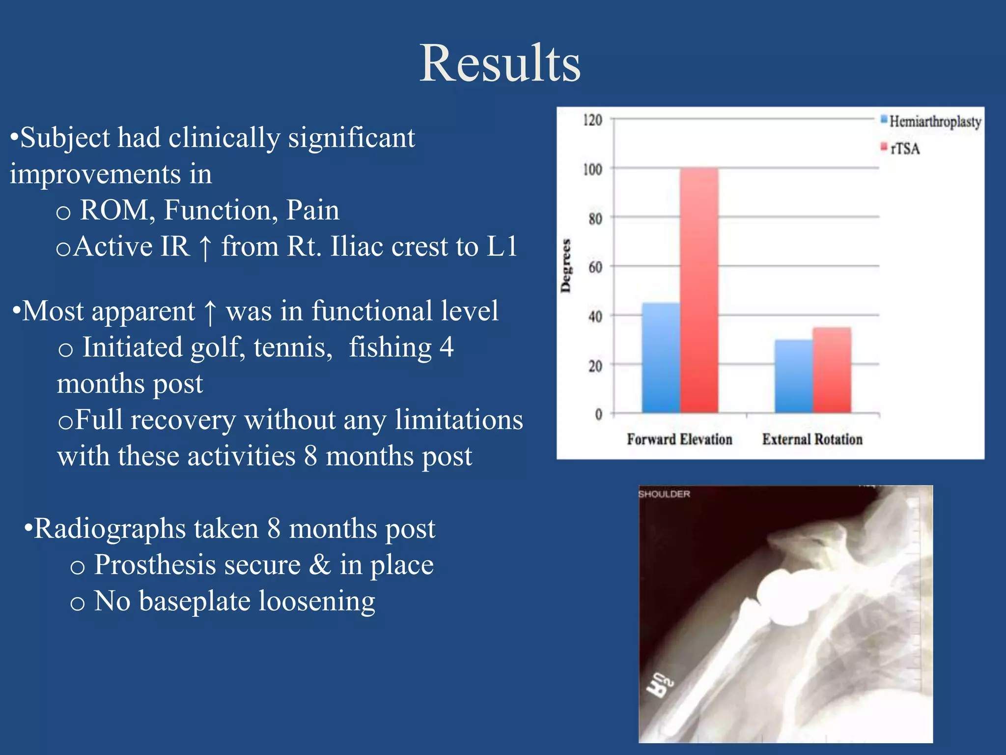 Reverse Total Shoulder Arthroplasty Research Presentation | PPT | Free ...