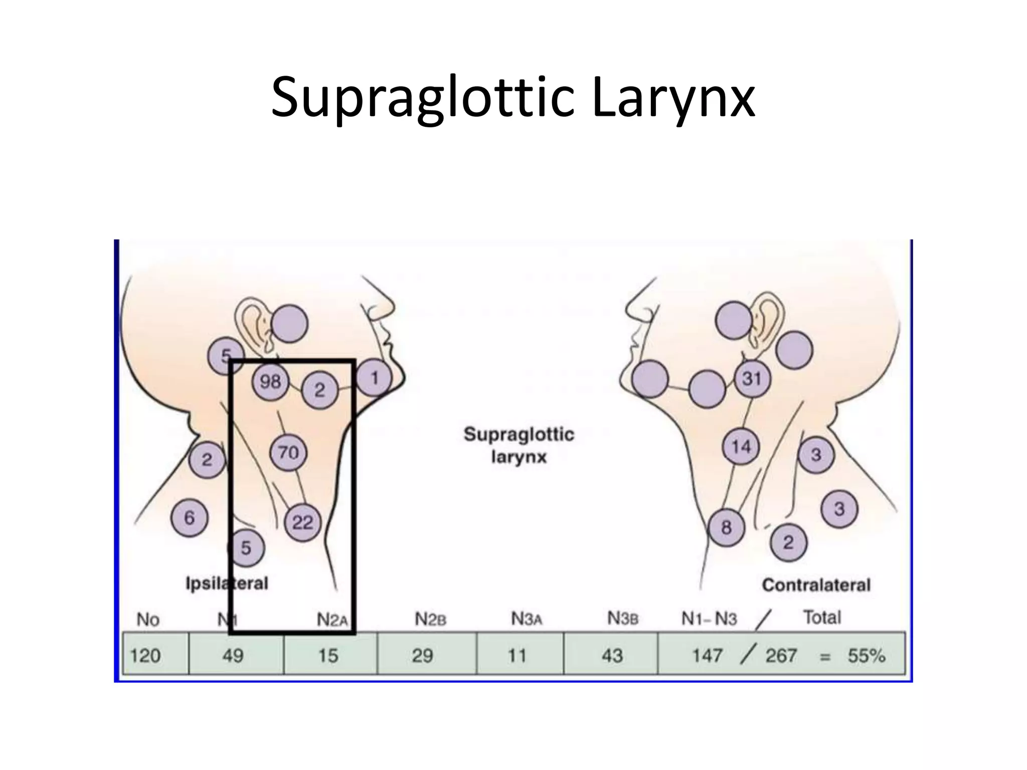 Rt techniques in ca larynx | PPTX
