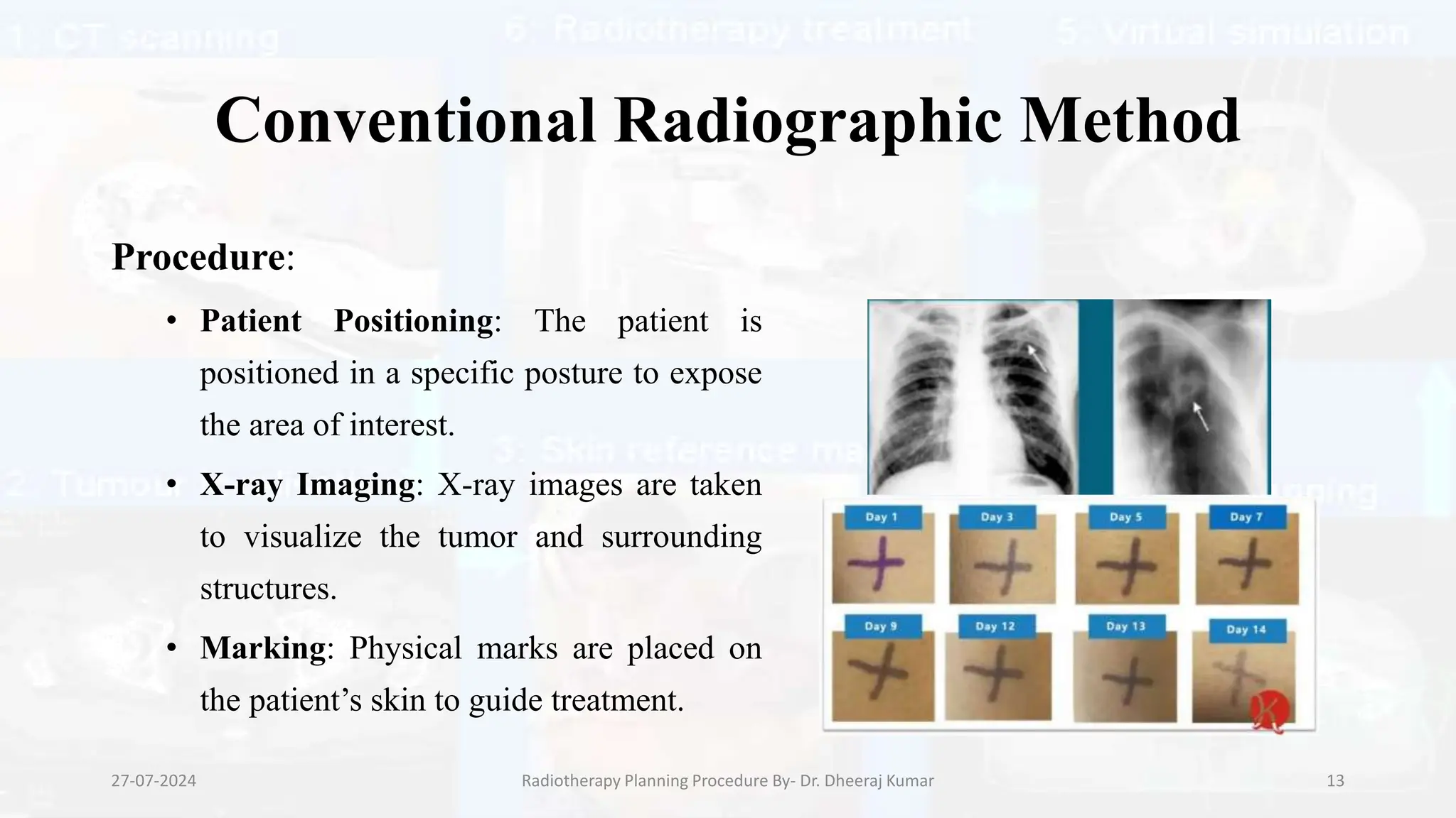 Radiotherapy Treatment Planning Procedure.pptx