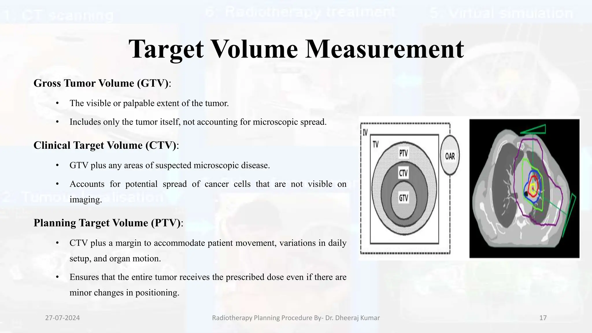 Radiotherapy Treatment Planning Procedure.pptx