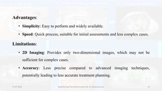 Radiotherapy Treatment Planning Procedure.pptx