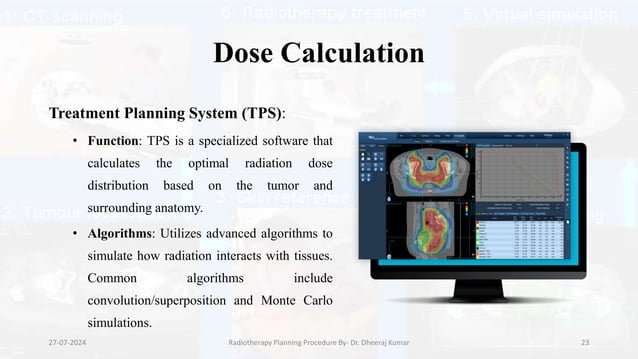 Radiotherapy Treatment Planning Procedure.pptx | 3-D Graphics ...
