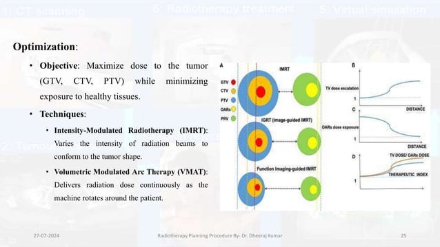 Radiotherapy Treatment Planning Procedure.pptx | 3-D Graphics ...