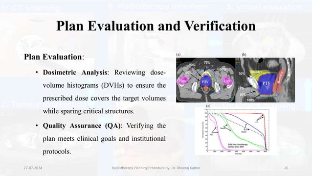 Radiotherapy Treatment Planning Procedure.pptx | 3-D Graphics ...