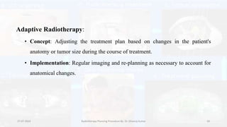 Radiotherapy Treatment Planning Procedure.pptx