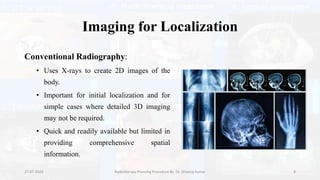Radiotherapy Treatment Planning Procedure.pptx