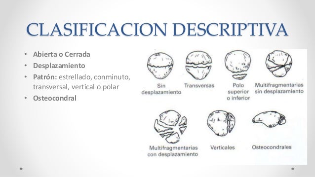 Fractura de rótula (1)