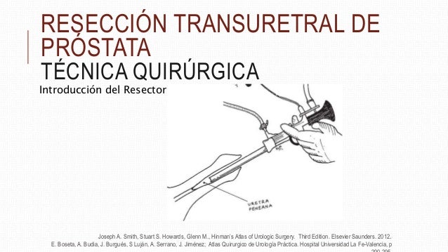 Reseccion Transuretral de Prostata, tecnica quirurgica