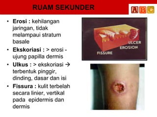 Ruam kulit.ppt