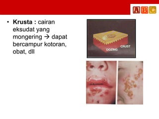 Ruam kulit.ppt