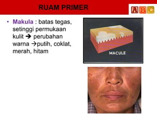 Ruam kulit.ppt