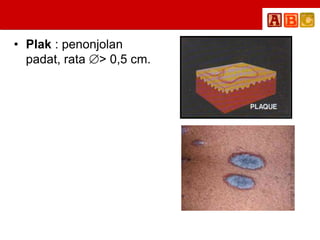 Ruam kulit.ppt
