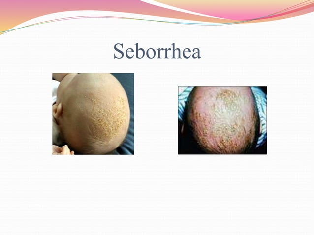 Ruang lingkup asuhan neonatus, bayi & balita | PPTX