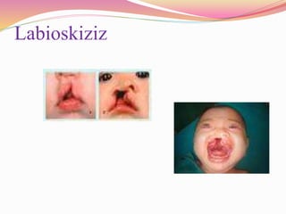 Ruang lingkup asuhan neonatus, bayi & balita | PPTX