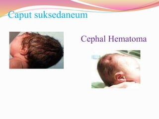 Ruang lingkup asuhan neonatus, bayi & balita | PPTX