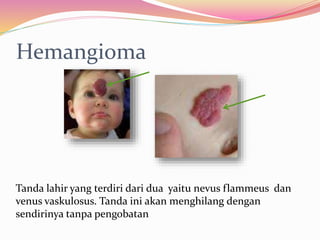Ruang lingkup asuhan neonatus, bayi & balita | PPTX