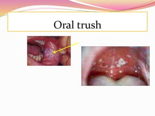 Ruang lingkup asuhan neonatus, bayi & balita | PPTX