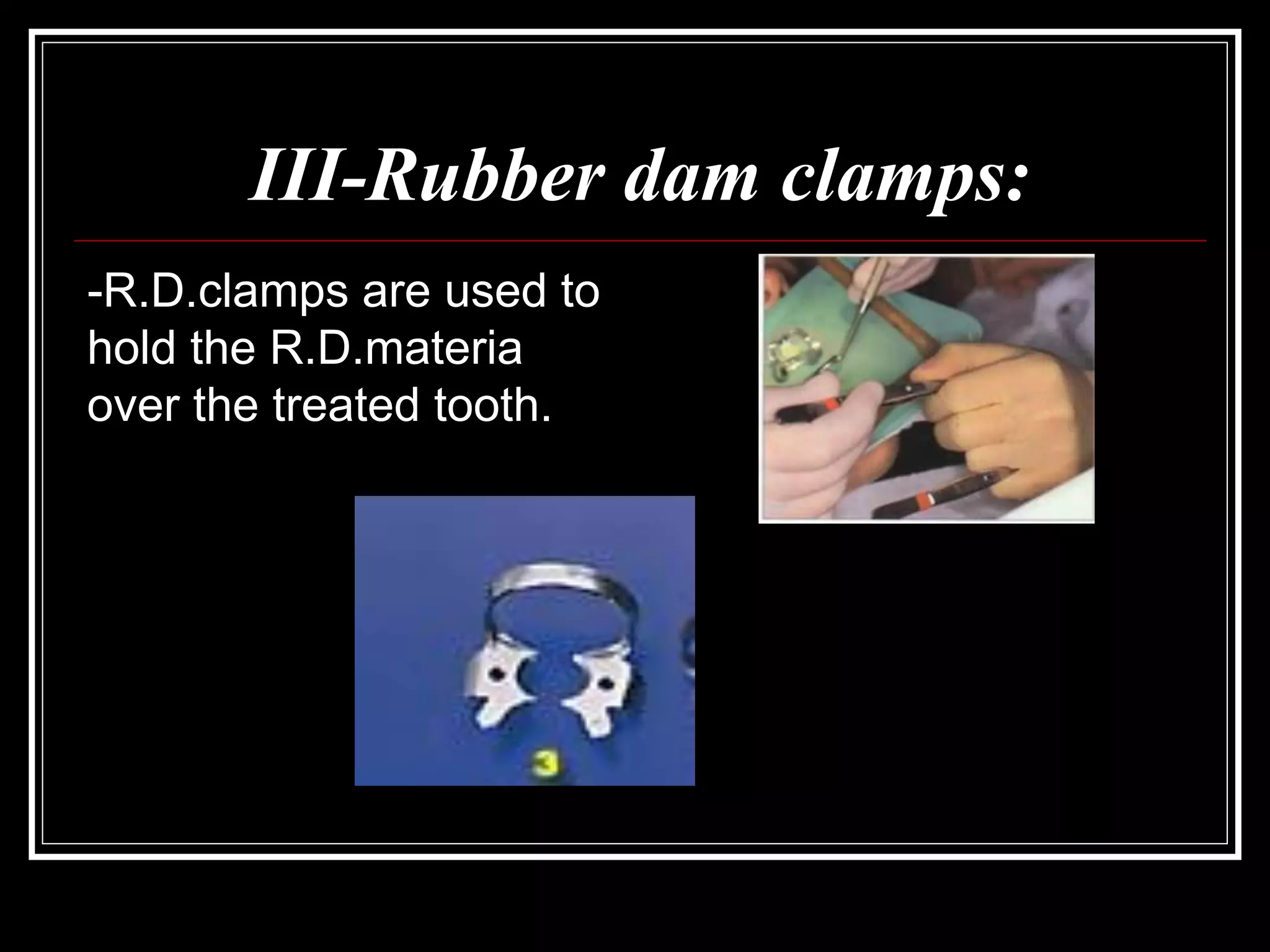 Rubber dam | PDF
