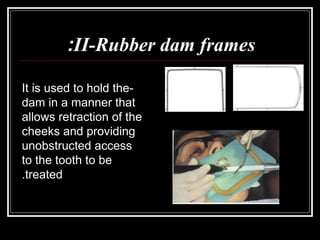 Rubber dam | PPT | Dental Health | Diseases and Conditions