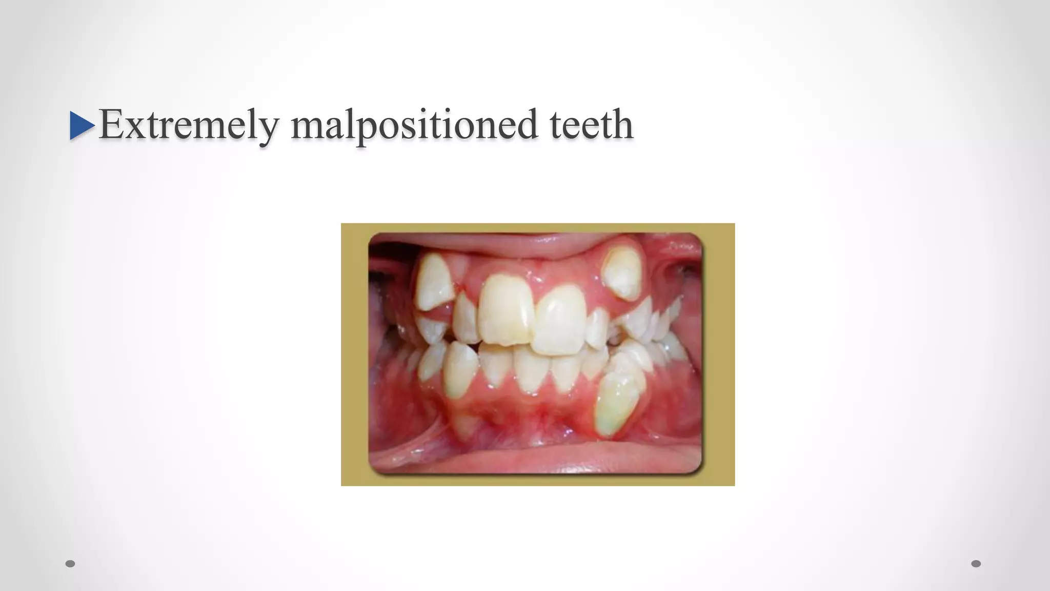 Rubber dam in Dentistry | PPTX