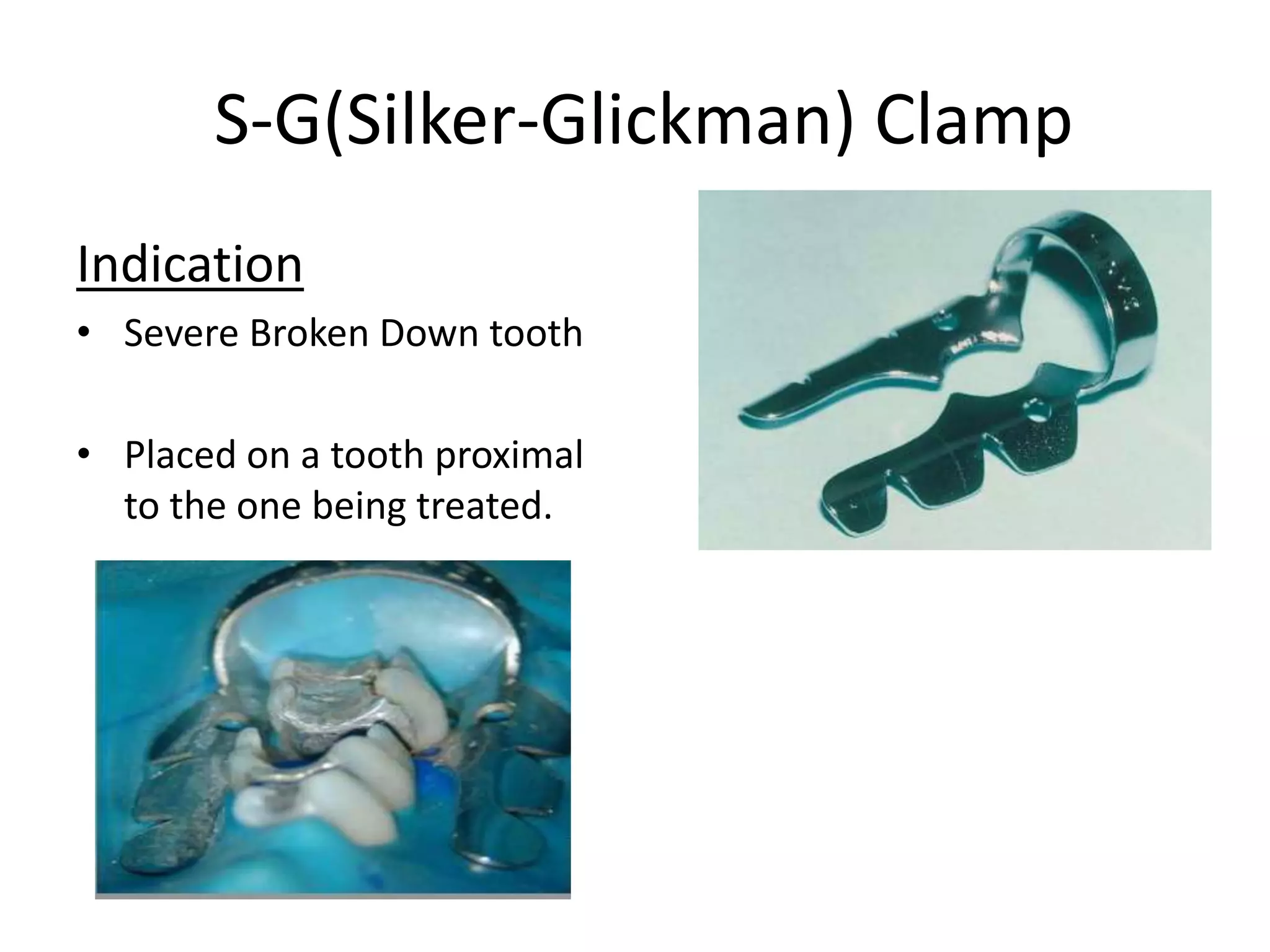 Rubber dam application | PPTX