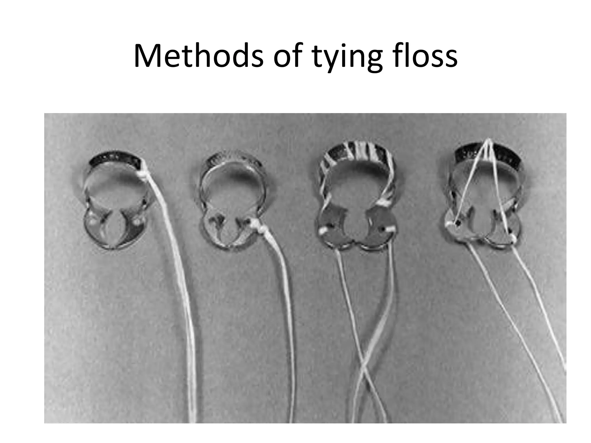 Rubber dam application | PPTX
