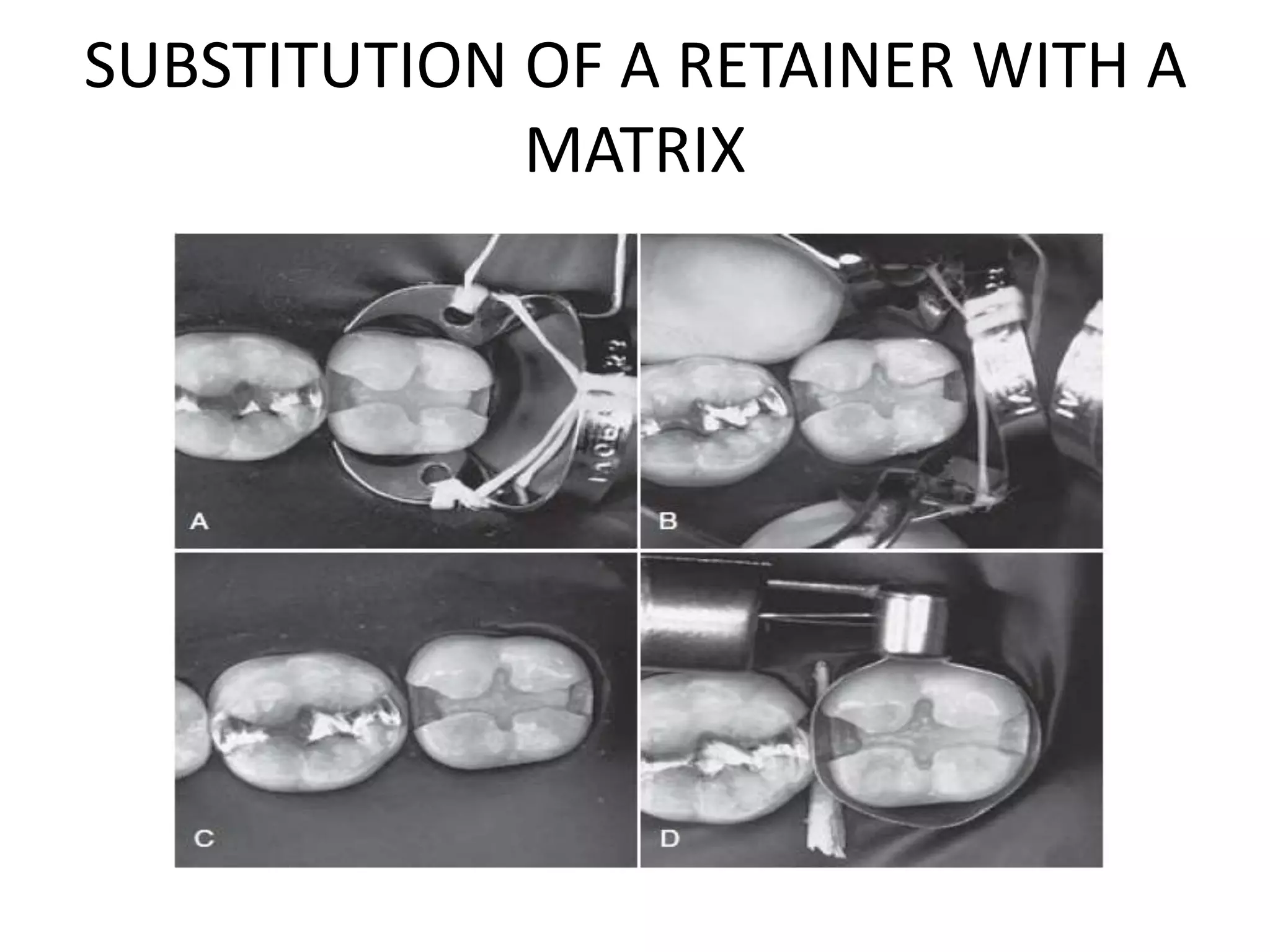 Rubber dam application | PPTX