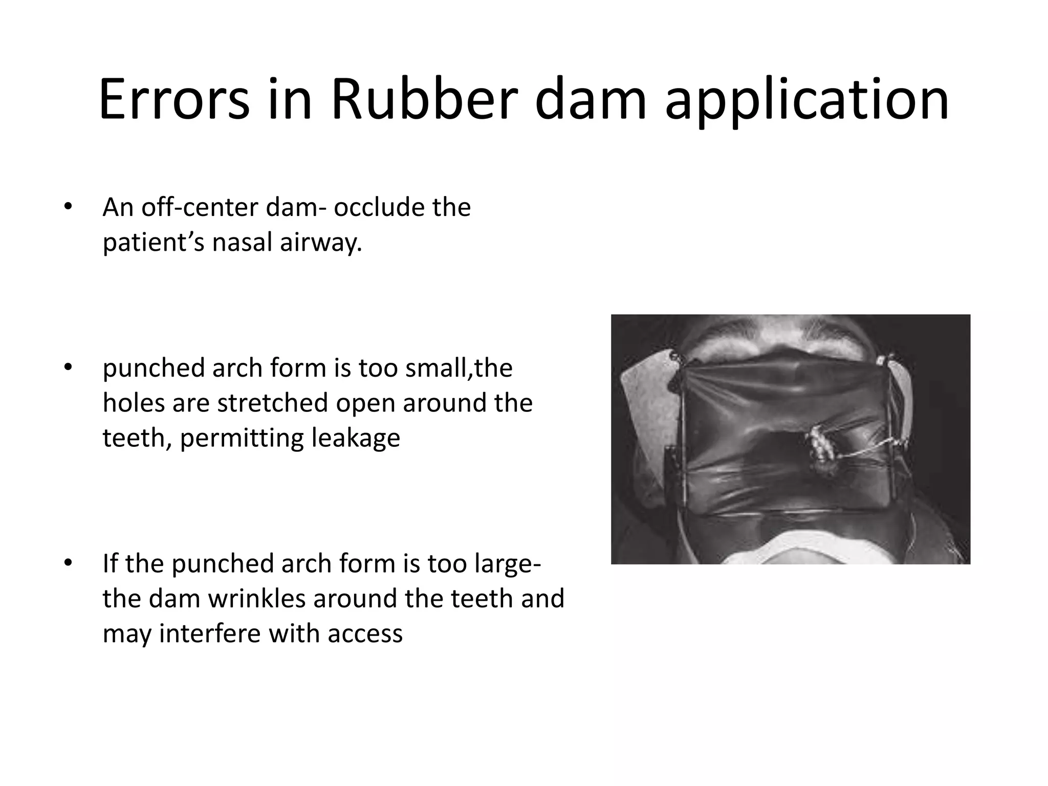 Rubber dam application | PPTX