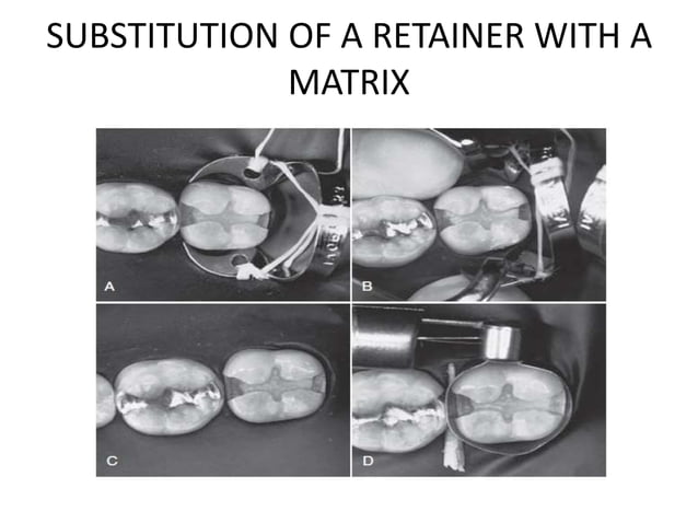 Rubber dam application | PPTX | Oral care | Personal Care