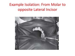 Rubber dam application | PPTX