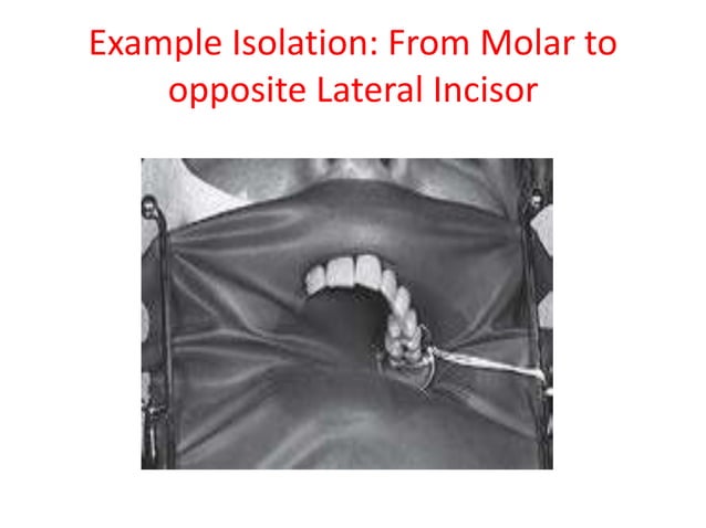 Rubber dam application | PPTX | Oral care | Personal Care