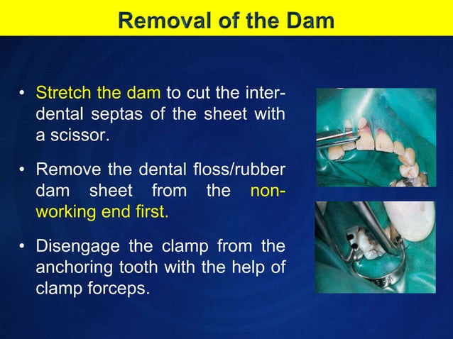 Rubber dam isloation | PPTX