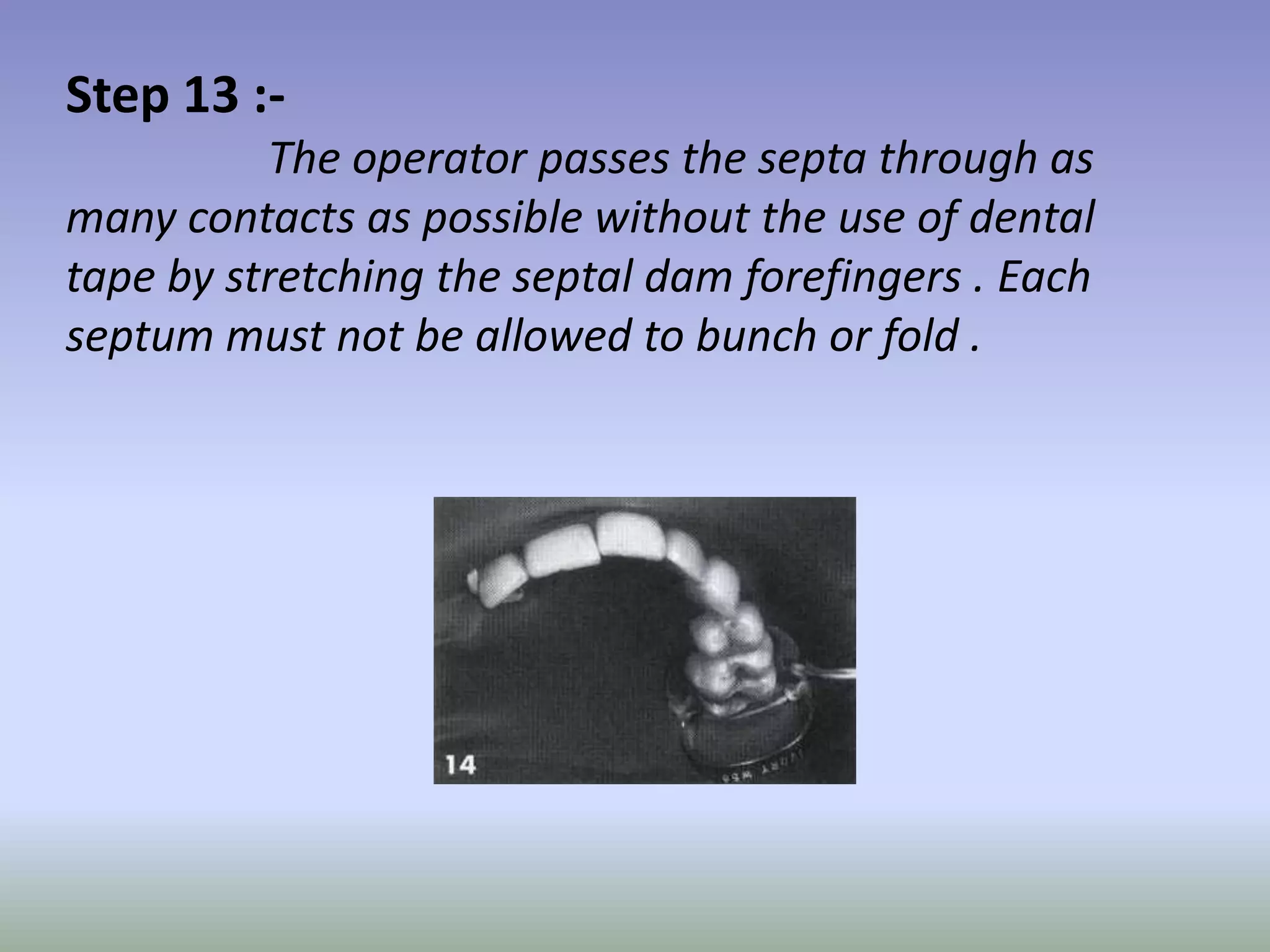 Rubber dam isolation | PPTX