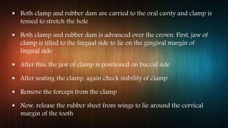 Rubber dam isolation | PPTX