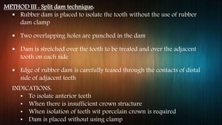 Rubber dam isolation | PPTX